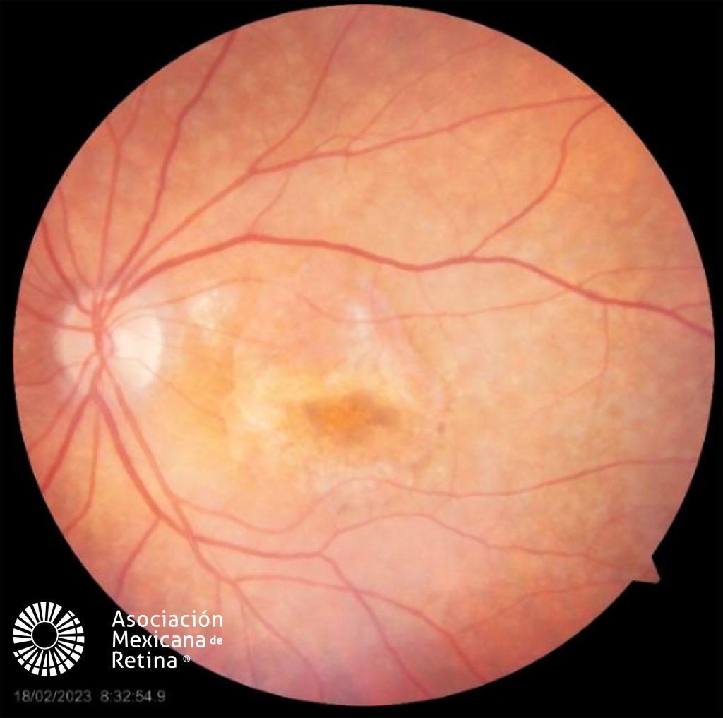 Fotos clínicas – AMR