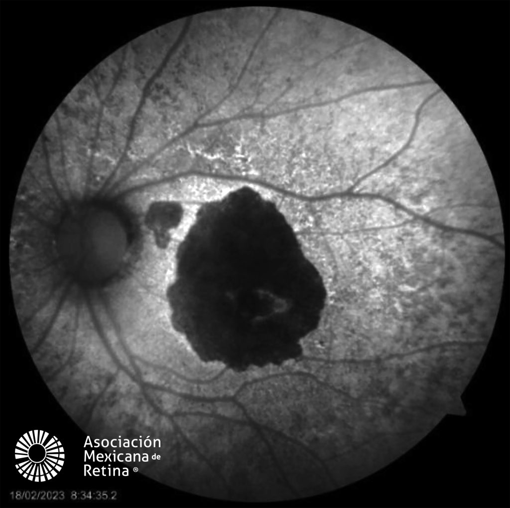 Imágenes Autofluorescencia – AMR